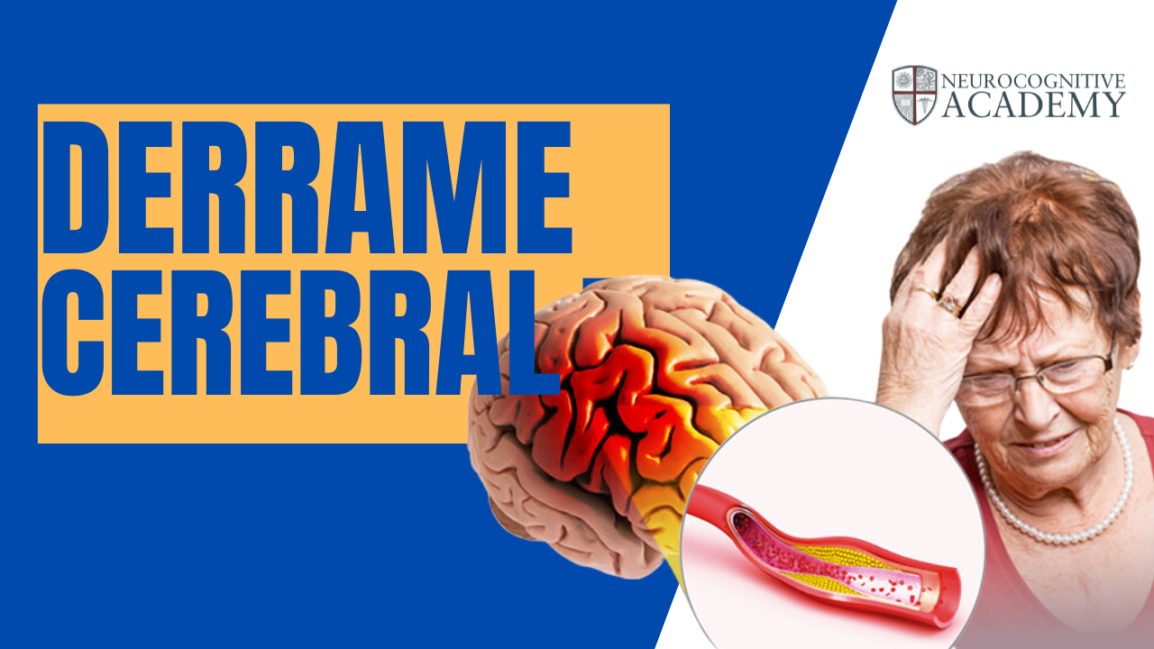 Derrame cerebral - Neurocognitive Academy